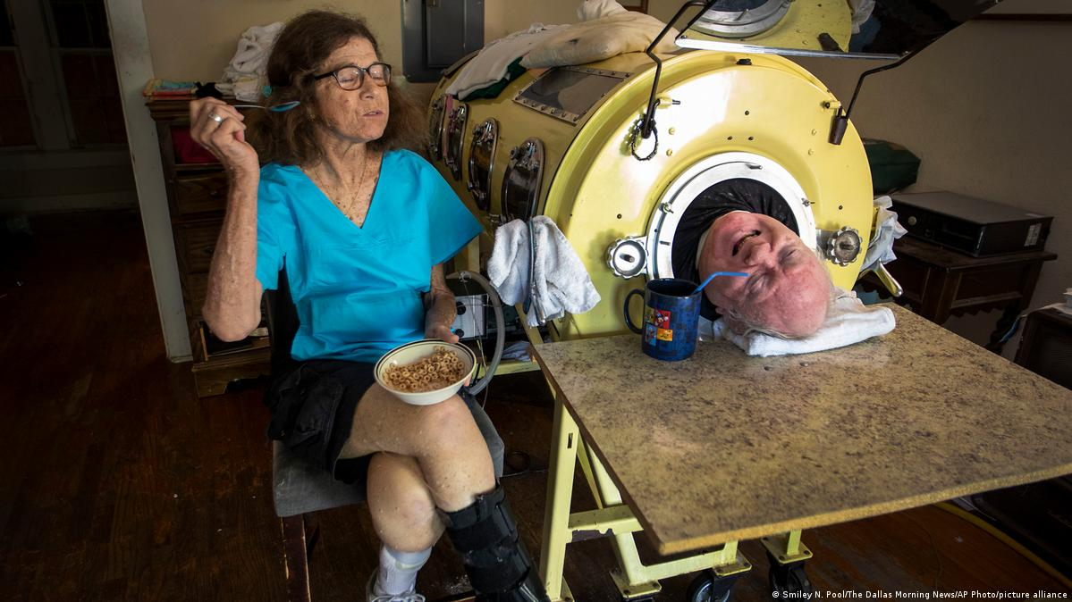 Adiós a Paul Alexander, el hombre que vivió 78 años dentro de un ...
